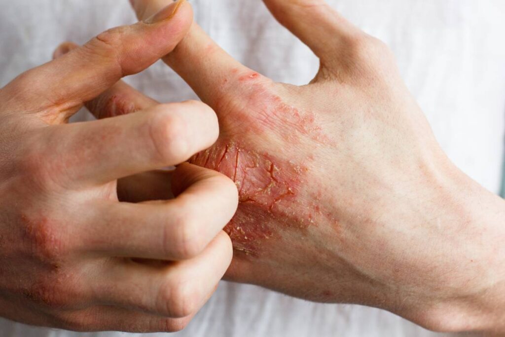 Five Reasons Why People May Develop Skin Problems - Health2wellness